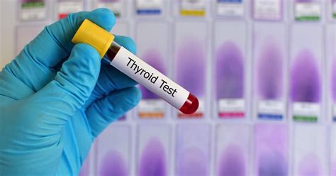 Cancer Thyroide Test Thyroide Bilan Thyroidien Et Diagnostic De
