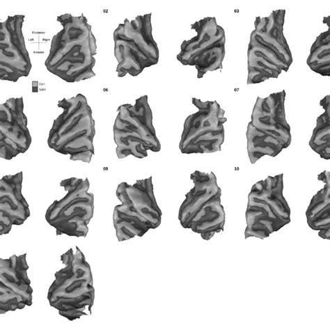 Individual Superior Temporal Cortex Middle Gray Matter Surface