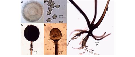 Molecular Phylogeny Identification And Pathogenicity Of 56 Off