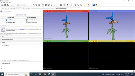 Error In Opening Files Using Slicer 562 Development 3d Slicer