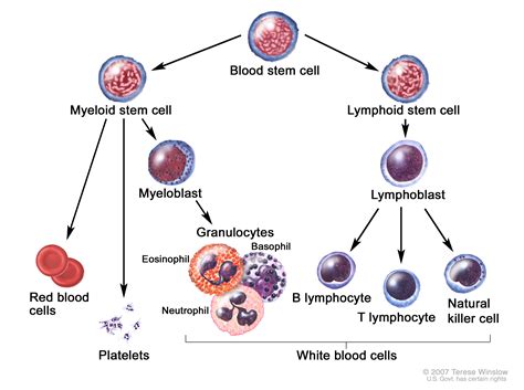 Hairy Cell Leukemia Treatment PDQ Cure Today