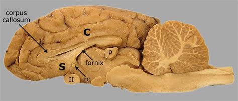Bisected Sheep Brain