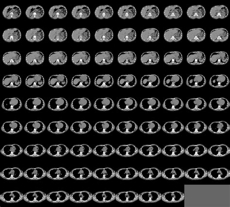 choose approach for medical image visualization matlab and simulink
