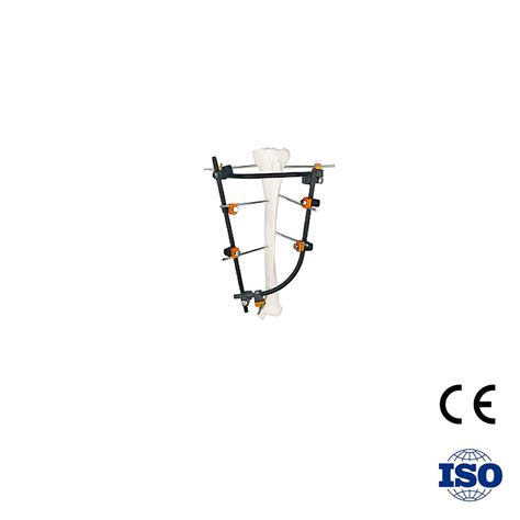 Orthopedic Trauma Tibial Joint External Fixator System For Tibia Fracture China Ilizarov And
