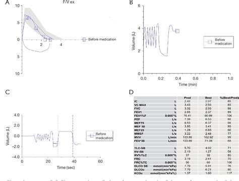Figure 3 From A New Method For Accurately Localizing And Resecting Pulmonary Nodules Semantic