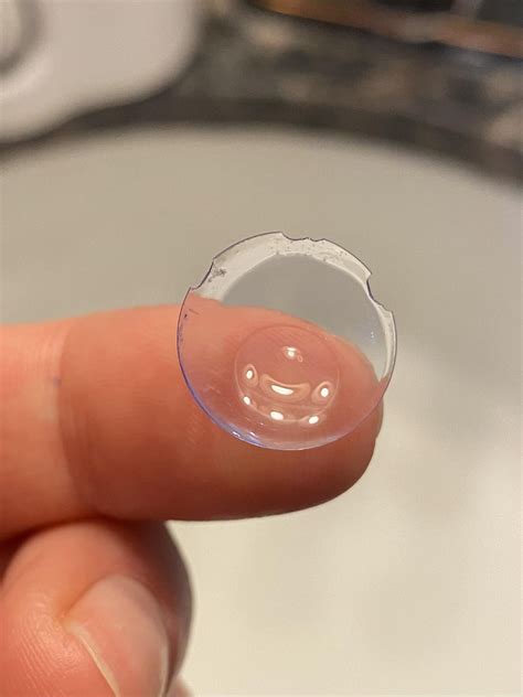 Does Anyone Know Why This Keeps Happening To My Contacts Rcontacts