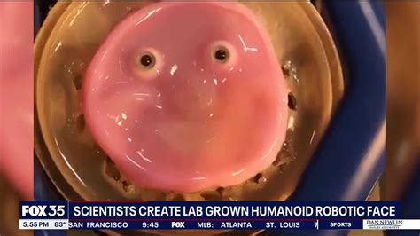 akash selvadoss n on linkedin livingskin techinnovation robotrevolution