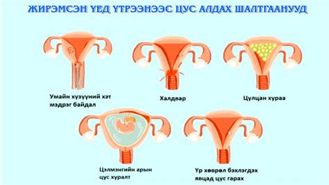 ЖИРЭМСНИЙ ЭРТ ХУГАЦААНД ЯАГААД ҮТРЭЭНЭЭС ЦУС ГАРДАГ ВЭ НӨАГ ын Эх