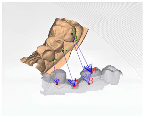 Prosthesis An Open Access Journal From Mdpi Prosthesis An Open Access Journal From Mdpi