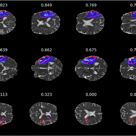 Overview Of The Focal Unet Architucture Download Scientific Diagram