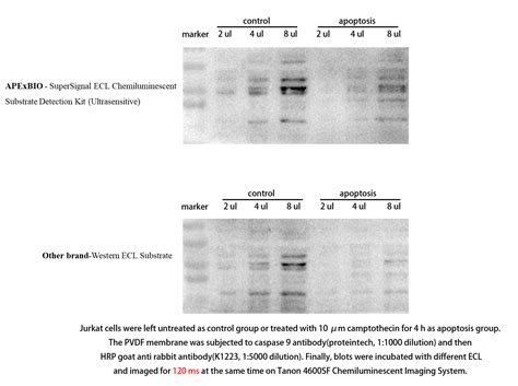 Supersignal Ecl Chemiluminescent Substrate Detection Kit
