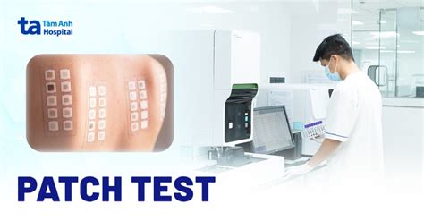 Patch Test Là Gì Hướng Dẫn Toàn Diện Đơn Giản Và Hiệu Quả