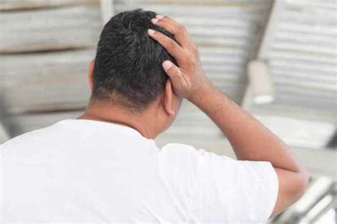 Man Suffers Memory Loss After Afternoon Sex With His Wife