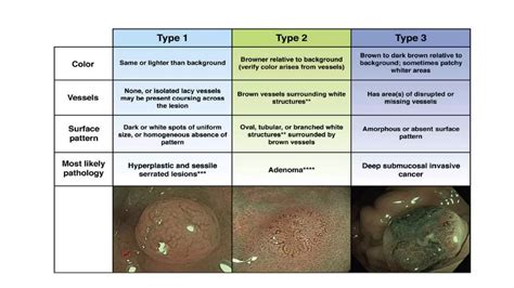 Colorectal Polyp Pptx