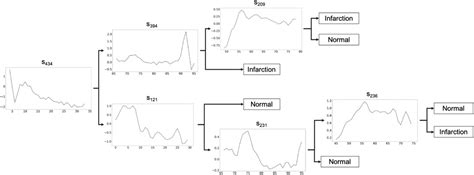Frontiers Matrix Profile Based Interpretable Time Series Classifier