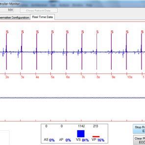 Pacemaker Pulse Generator 6 Download Scientific Diagram