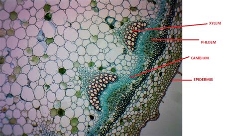 Solved Label Epidermis Xylem Phloem And Cambium Layer