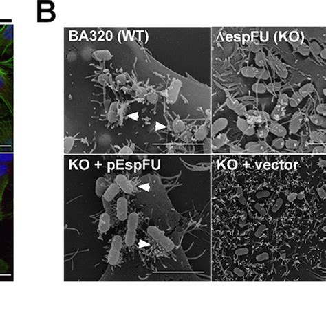Actin Pedestal Formation By Epec Induces The Expression Of Genes Download Scientific Diagram