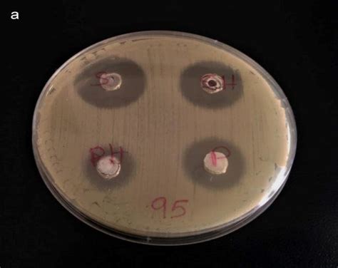 Agar Diffusion Method Showed The Antibacterial Activity Of Different