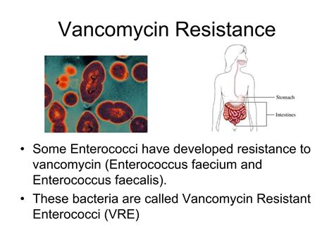 Tdm Vancomycin Pdf Pdf