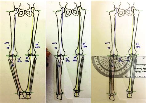simulation of correction using paper tracings download scientific