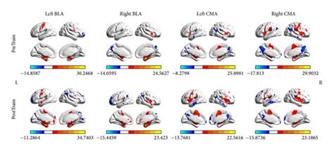 Whole Brain Voxelwise Rsfc Patterns Of Basolateral Amygdala Bla And