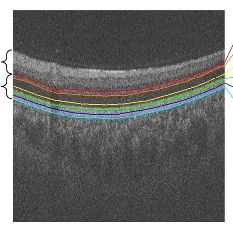 Illustration Of The Outer Retina Layered Structure From Top To Download Scientific Diagram