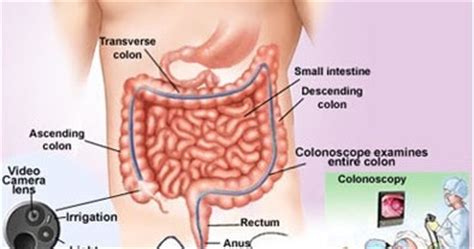 Colorectal Cancer Screening ICD 9 And CPT Codes Medical Billing And Coding Online