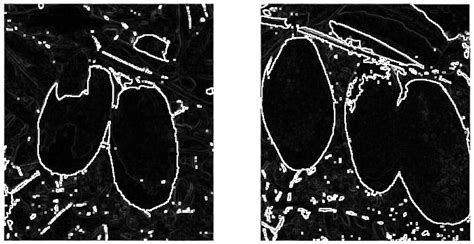 A Marker Controlled Watershed Algorithm For The Intelligent Picking Of