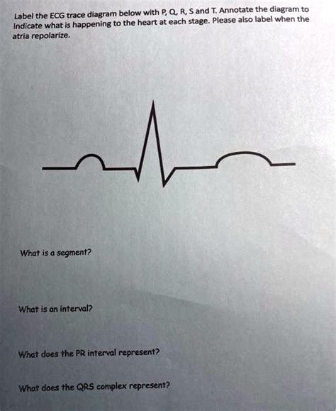 Solved Texts Label The Ecg Trace Diagram Below With P Qrs And T