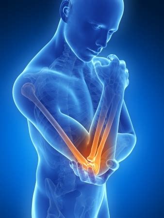 What Type Of Therapy Is Needed After Elbow Surgery Plano Orthopedic Sports Medicine Center