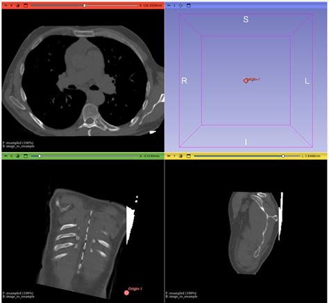 Resample Scalarvectordwi Volume Produces Weird Results Support 3d Slicer Community