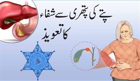 Pitte Ki Bimari Aor Pathri Ka Ilaj The Power Of Dua