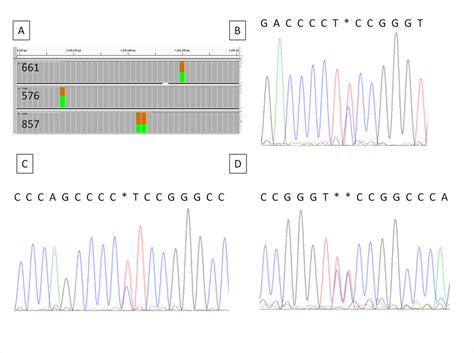 Confirmation Of Tert Mutations By Sanger Sequencing Panel A Is A Download Scientific Diagram