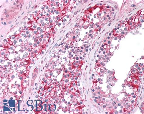 Ihc Plus™ Gamt Polyclonal Antibody Rabbit Anti Human Lsbio