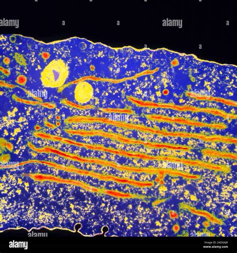 Rough Endoplasmic Reticulum Transmission Electron Micrograph Tem Of A Section Through A