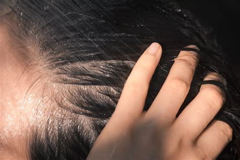 Healthy Scalp Routine