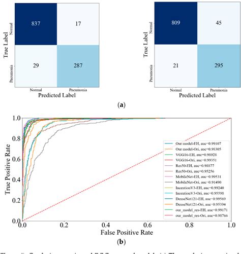 Figure 1 From Pneumonia Detection From Chest X Ray Images Based On Convolutional Neural Network