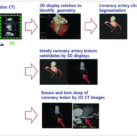 Three Dimensional Cardiac Ct Navigator Usage Examples The 3d Display