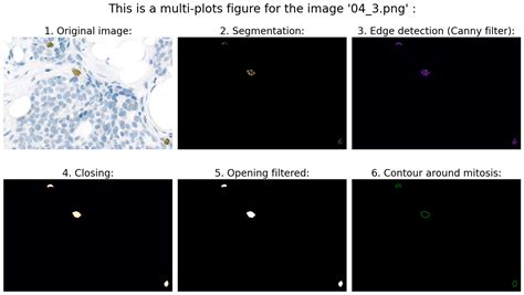 Automated Mitosis Detection And Analysis In Histological Images Using Opencv And Image