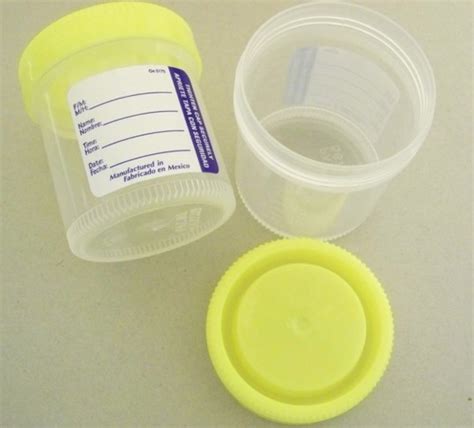 Parkview Health Laboratory Test Directory