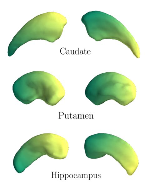 A Convolutional Autoencoder Approach To Learn Volumetric Shape
