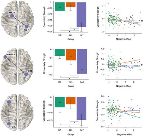 Disease Related Alterations In Effective Connectivity The Middle Panel
