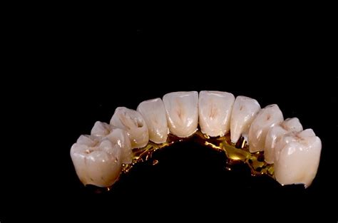 Plamen Vasilev On Linkedin Daily Work At Tusk Dental Technologies