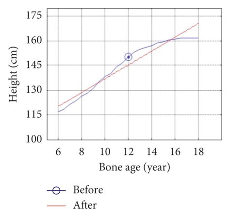Polynomial Fit Map Of Girls Based On Bone Age Growth Trend A Linear Download Scientific