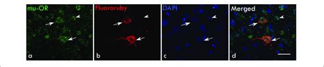 Retrograde Labeling For Magnocellular Projection Neurons In Lman A