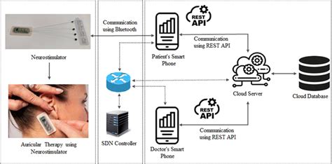 Sdn—iot Based Neurostimulator Health Monitoring System Download