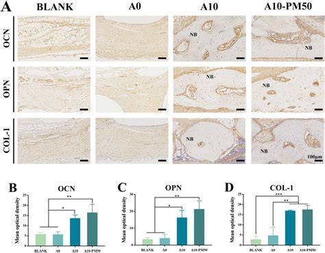 A Immunohistochemical Staining Of OCN OPN And COL At Week After Download Scientific