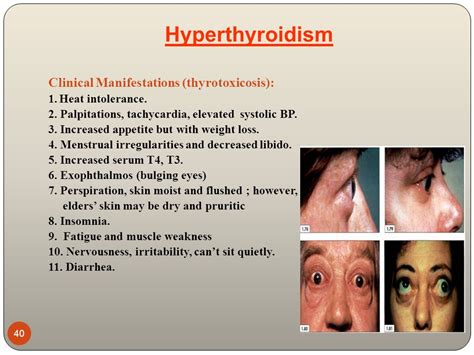 Chapter 42 Assessment And Management Of Patients With Endocrine Disorders 17 11 Ppt Download