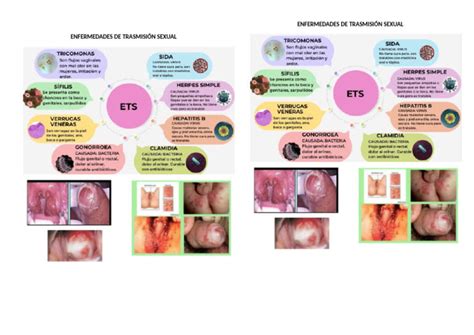 Enfermedades De TranmisiÓn Sexual Pdf Enfermedades De TranmisiÓn Sexual Pdf
